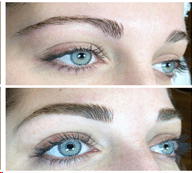 Microblading - Reading Dermatology