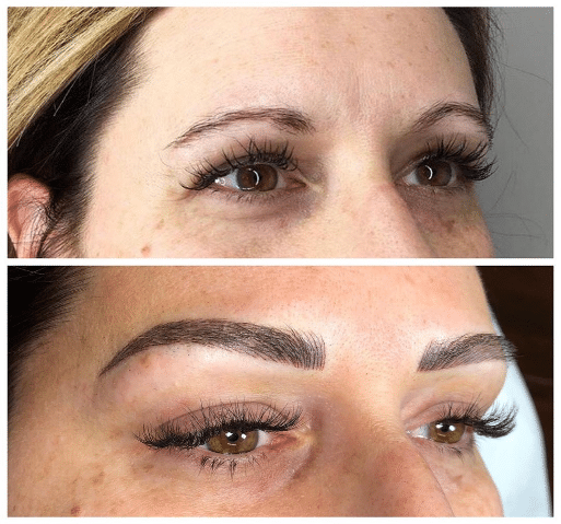 Microblading - Reading Dermatology