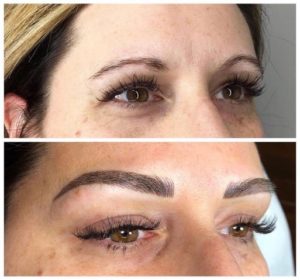Microblading - Reading Dermatology